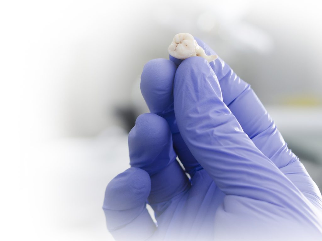 Bromley Smiles Dental surgical extractions